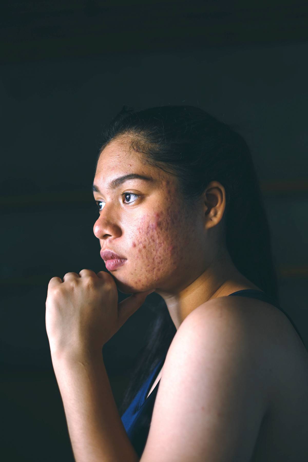 Canva Portrait Of A Woman Perfect Skin Solutions