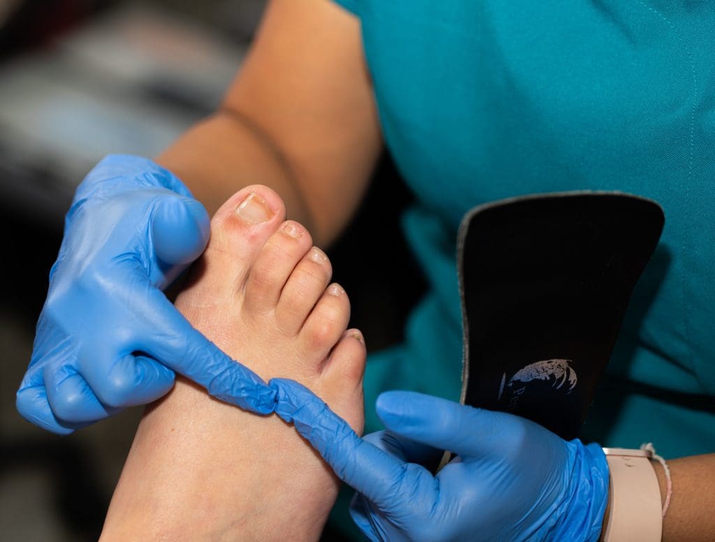 Foot Fillers at Perfect Skin Solutions
