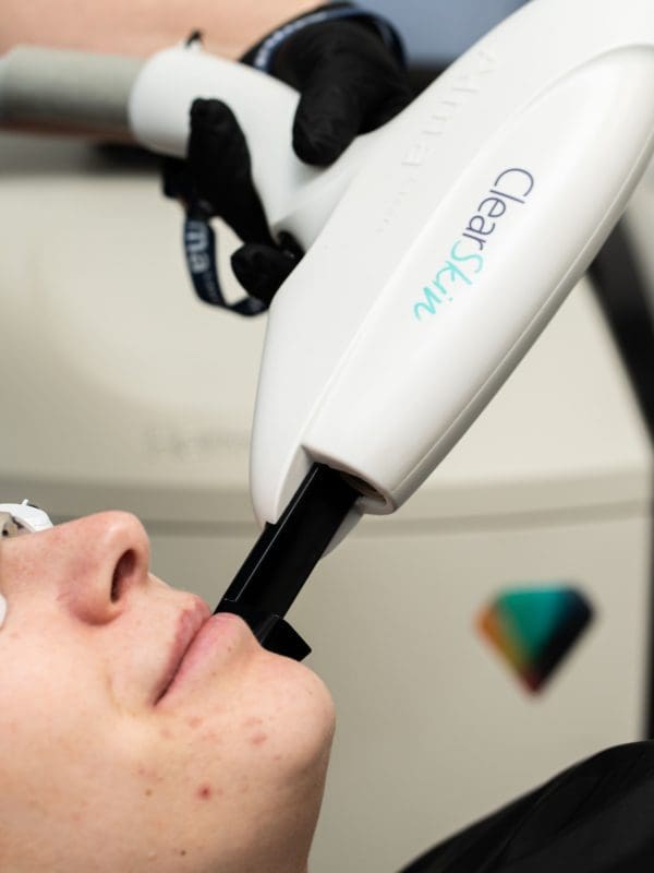 Dermalux Tri-Wave MD - NEW! - Perfect Skin Solutions