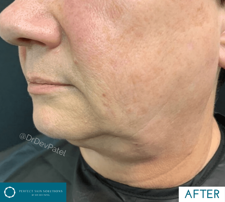 Lumecca - Perfect Skin Solutions