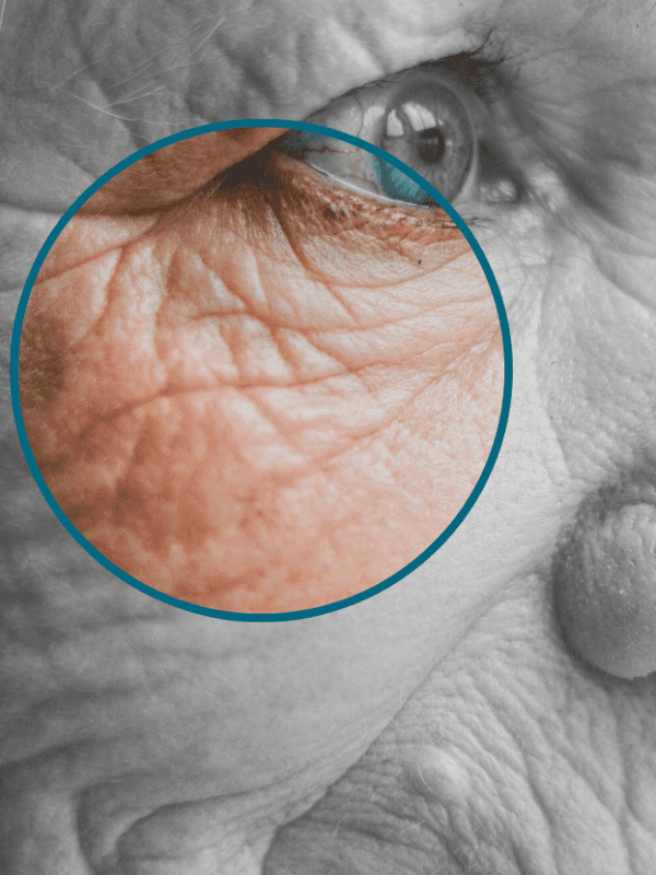 DNA Polynucleotide | Skin Revitalisation Treatment - Perfect Skin ...