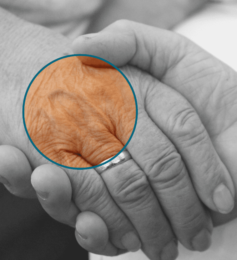 Ageing Hands - Perfect Skin Solutions