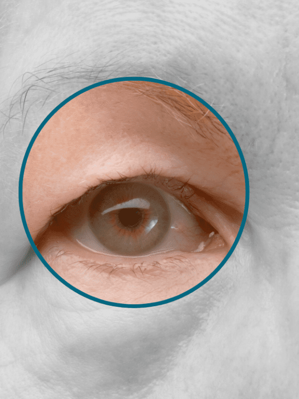 NeoGen PSR Treatment | NeoGen Start from £300 - Portsmouth, UK | Best ...