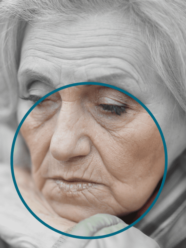 iPixel SKIN RESURFACING - Perfect Skin Solutions