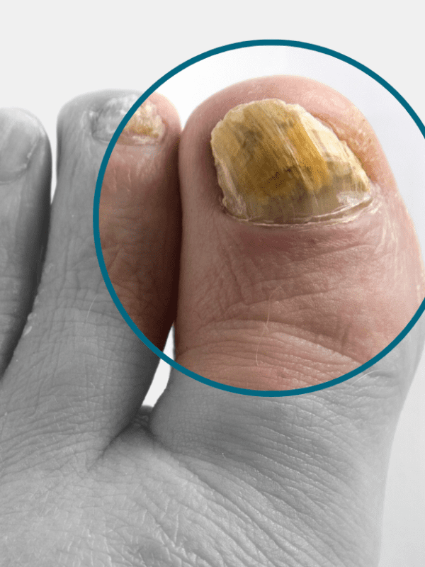 Podiatrist & Chiropody Services | Podiatry Treatments Portsmouth