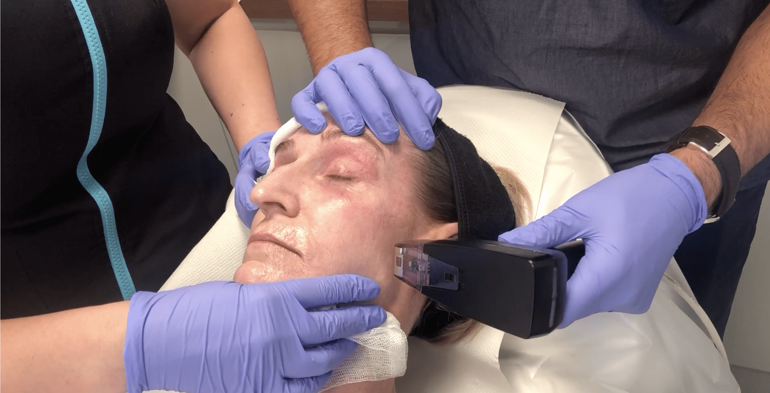 Dr Dev Patel features in Marie Claire | Perfect Skin Solutions | Southsea