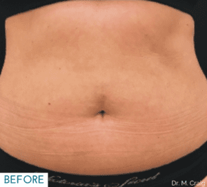 EvolveX - Perfect Skin Solutions