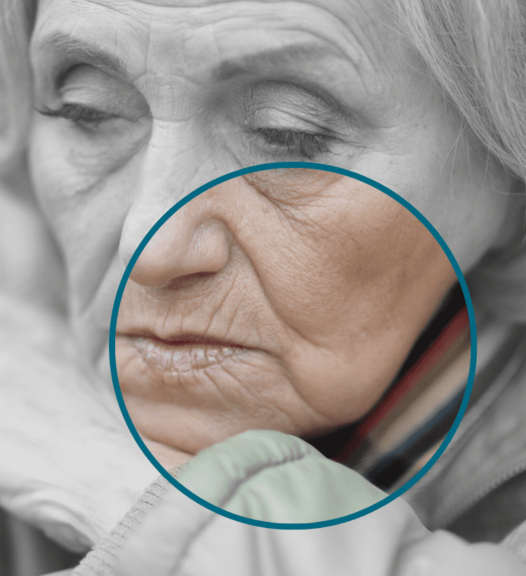 Sagging Skin Treatments