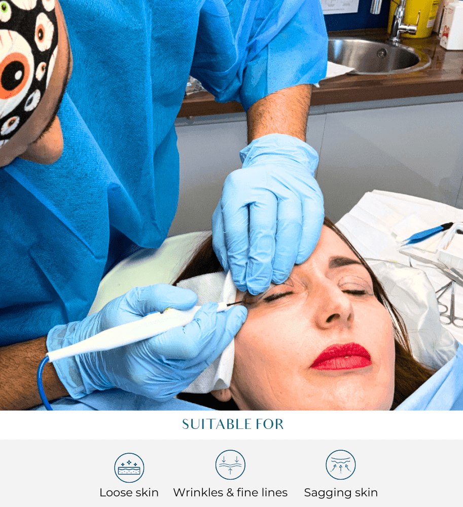 Eye Surgery - Perfect Skin Solutions