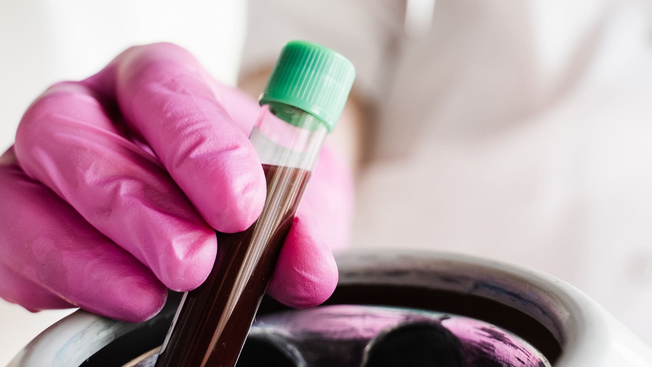 Top PRP Treatment for Face: Enhance Your Skin’s Natural Rejuvenation