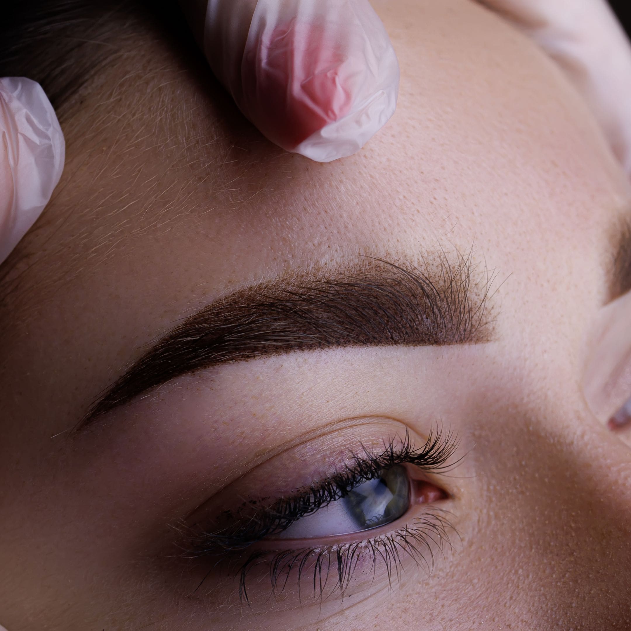 Laser Eyebrow Tattoo Removal - Perfect Skin Solutions